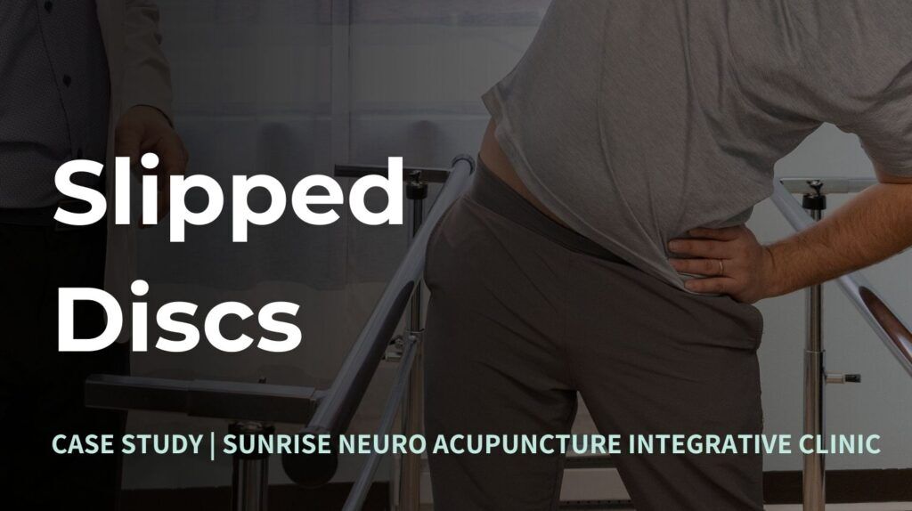 Sunrise Neuro Acupuncture Integrative Clinic